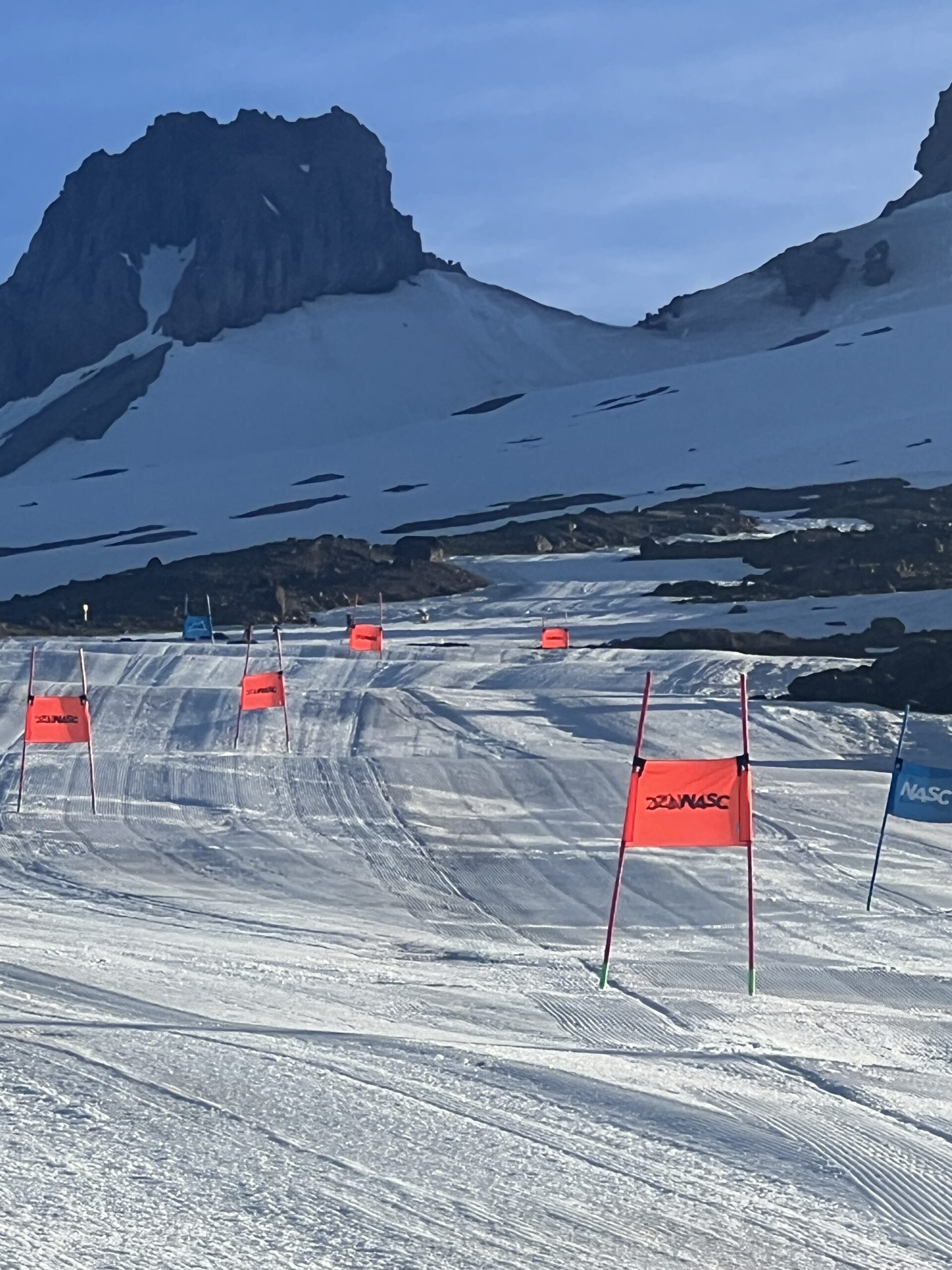 Now Is the Time to Lock In Your Summer Ski Race Training